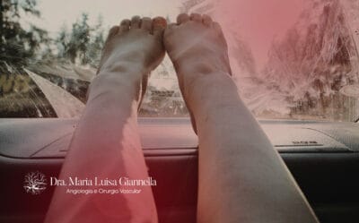 Inchaço nas Pernas - Saiba Mais sobre o Edema | Dra Maria Luisa